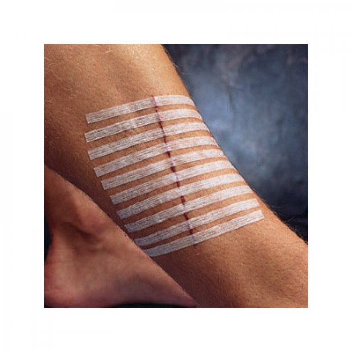 Novasis Medikal Ürünler